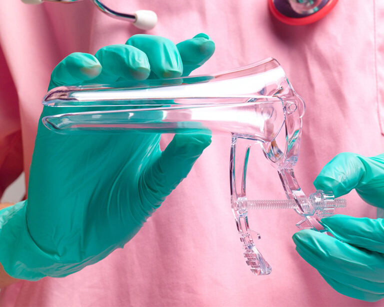 Cervical Screening Test (pap smear): The Essential Guide - Capstone ...