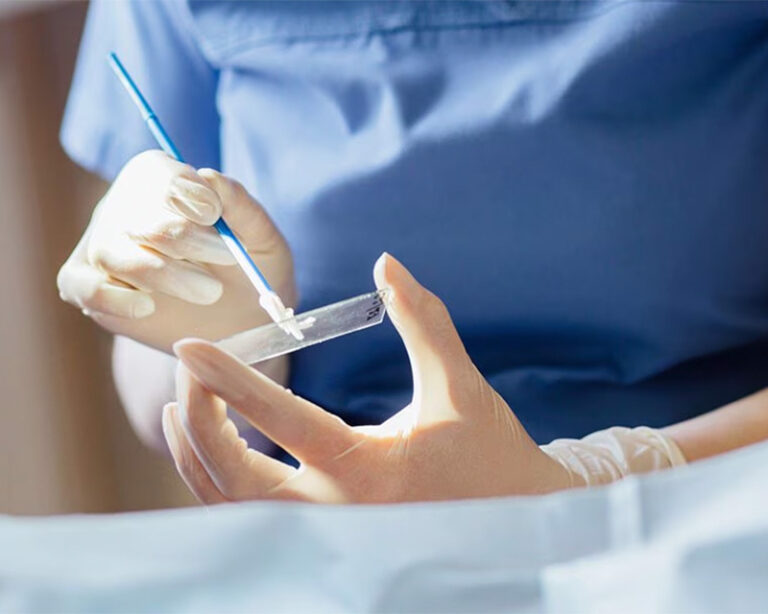 Cervical Screening Test (pap smear): The Essential Guide - Capstone ...